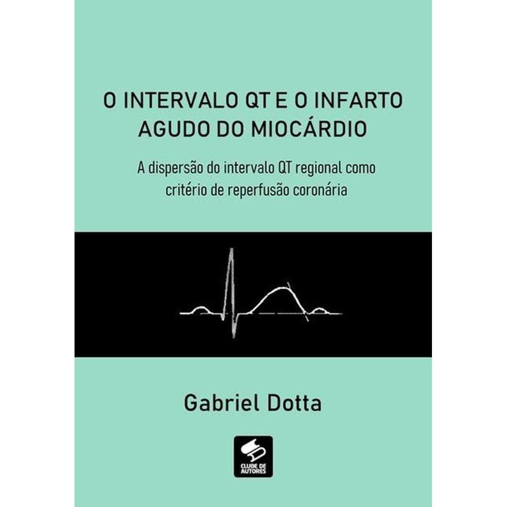 Guia infarto agudo miocardio | Pontofrio