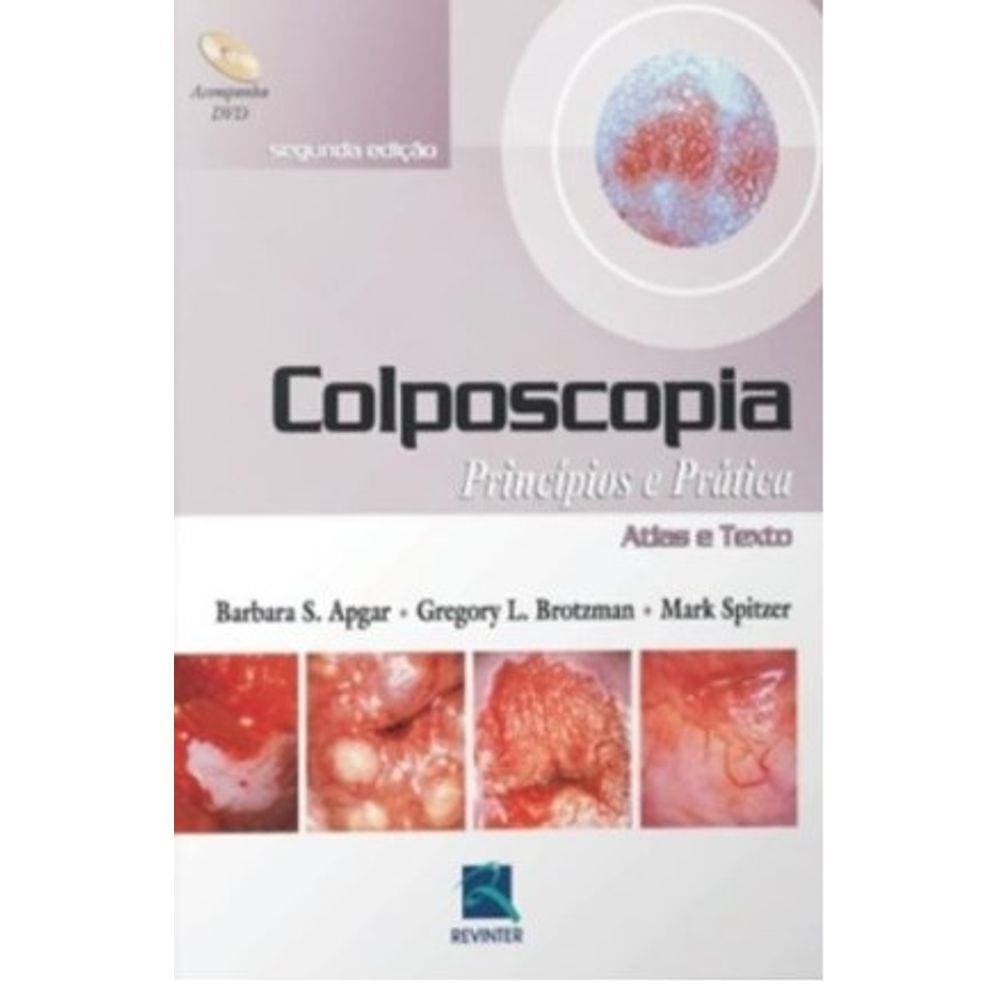 Colposcopia | Pontofrio